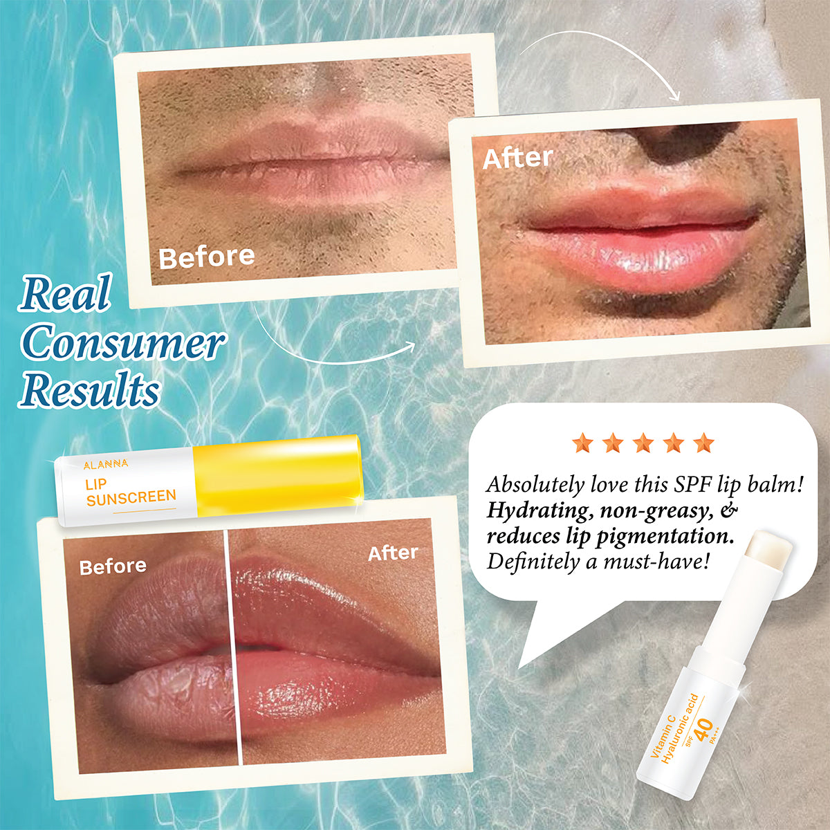 Lip Balm With SPF 40 for sun damage protection | ALANNA